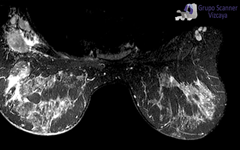 Imágenes RM mama - Grupo Scanner Vizcaya